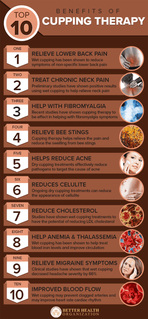 Workout Recovery Cupping Therapy I Fighting Arts Health Lab